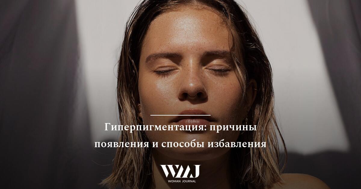 Гиперпигментация: причины появления и способы избавления | WMJ.ru